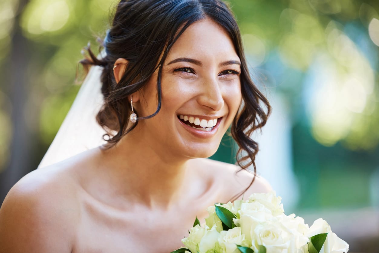 Bridal and Wedding Smile - Cosmetic Dentistry in Covent Garden